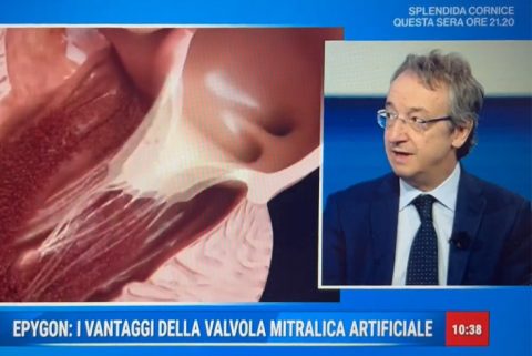 Interview with Pr Mauro Rinaldi, Head of Cardiac Surgery (in Italian ...